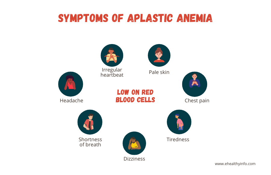 Aplastic Anemia Symptoms Causes And Treatments E Healthy Info