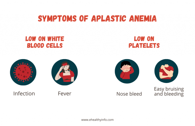 Aplastic Anemia Symptoms Causes And Treatments E Healthy Info